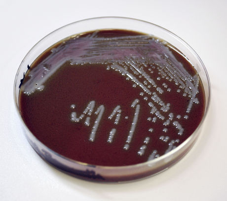 46 Gram negative Stock Pictures, Editorial Images and Stock Photos ...