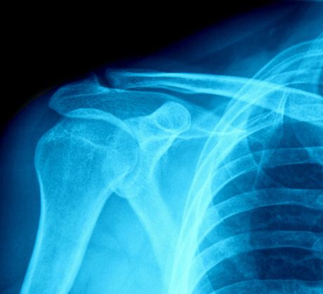 38 Humerus Stock Pictures, Editorial Images and Stock Photos | Shutterstock