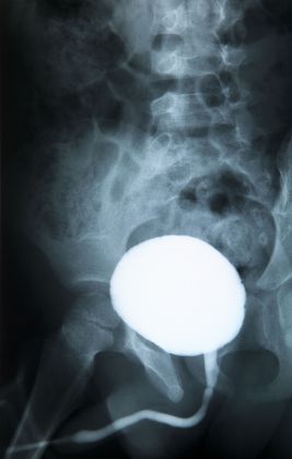 44 Urethra Stock Pictures, Editorial Images and Stock Photos | Shutterstock