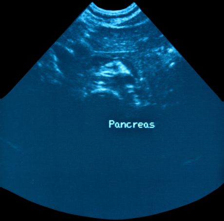 Pancreas Ultrasound Scan Editorial Stock Photo - Stock Image | Shutterstock