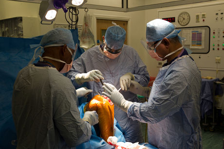 Total Knee Replacement Operation Editorial Stock Photo - Stock Image ...