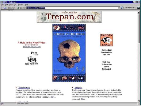 12 Trepanation Stock Pictures, Editorial Images and Stock Photos ...
