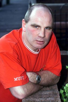 ANTHONY SMART OF CWMFELINFACH , WALES, WHO HAD NAIL EMBEDDED IN HIS ...