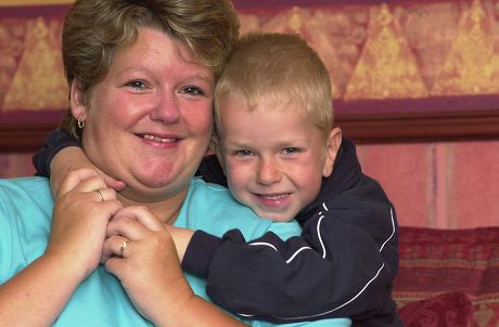 21 Exomphalos Stock Pictures, Editorial Images and Stock Photos ...