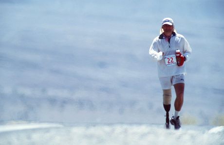 Chris Moon Who Lost His Leg Editorial Stock Photo - Stock Image ...