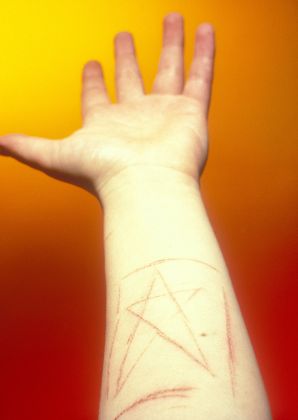 Self Harm Scars Person Star Scratched Editorial Stock Photo - Stock ...