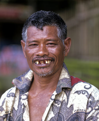 Balinese Man Smiling Bad Teeth Tooth Editorial Stock Photo - Stock ...