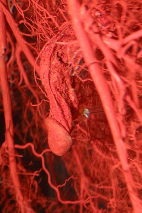 Real Human Body Body Worlds - Foto de stock de contenido editorial ...