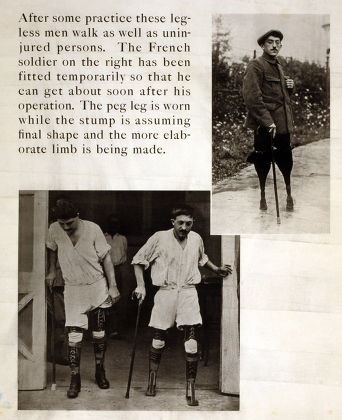 Soldiers Amputated Legs During Recovery 1919 Editorial Stock Photo ...