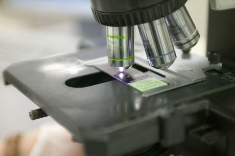 Closeup Slide Under Microscope Editorial Stock Photo - Stock Image ...