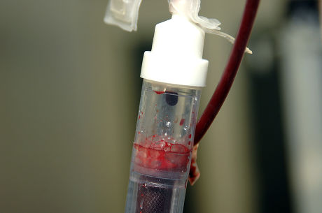 32 Intravenous therapy Stock Pictures, Editorial Images and Stock ...