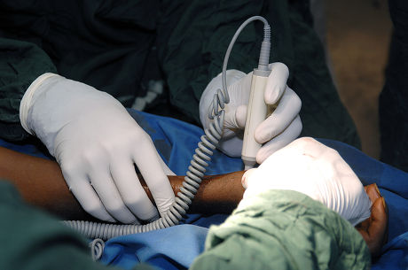 Model Released Surgeons Use Carotid Doppler Editorial Stock Photo ...