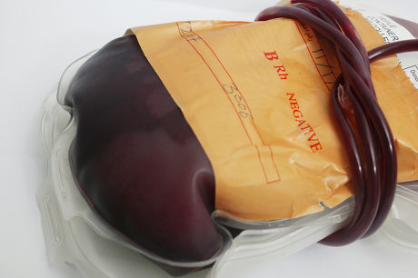 Blood Bag Containing Type B Negative Editorial Stock Photo - Stock ...