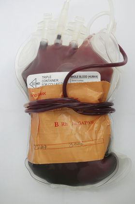 Blood Bag Containing Type B Negative Editorial Stock Photo - Stock ...