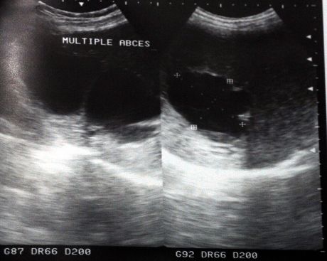 Model Released Ultrasound Revealing Series Multiple Editorial Stock ...
