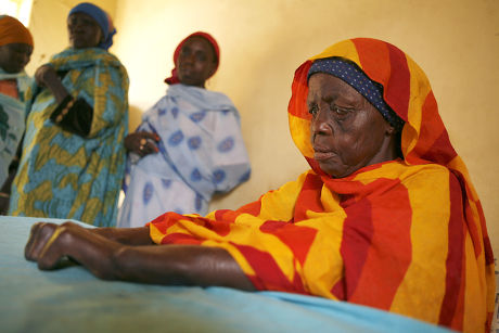 Elderly Woman Suffering Leprosy Waits Her Editorial Stock Photo - Stock ...