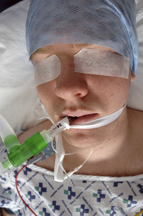 Close Face Anaesthetised Male Patient Editorial Stock Photo - Stock ...