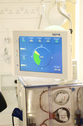 Hemodialysis Machine Which Connected Kidney Patient Editorial Stock ...