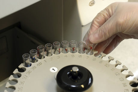 Automatized Processing Specimens Medical Laboratory Editorial Stock ...