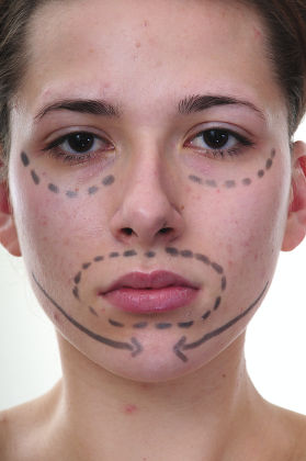 8 Zits Stock Pictures, Editorial Images and Stock Photos | Shutterstock