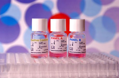__COUNT__ 'T SPOT - TB' TUBERCULOSIS BLOOD TEST DEVELOPED BY OXFORD ...