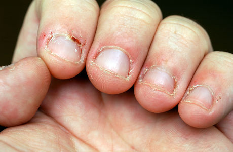 20 Chewing fingernails Stock Pictures, Editorial Images and Stock ...