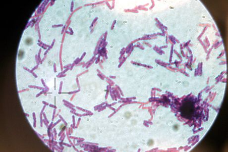 Anthrax Sample Under Microscope Editorial Stock Photo - Stock Image ...