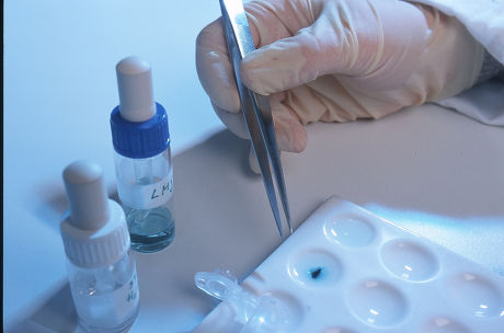 38 Blood test procedure Stock Pictures, Editorial Images and Stock ...