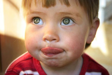 Model Released Little Girl Running Nose Editorial Stock Photo - Stock ...
