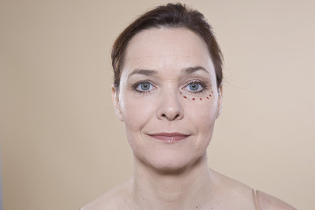Model Released Womans Face Marks Cosmetic Editorial Stock Photo - Stock ...