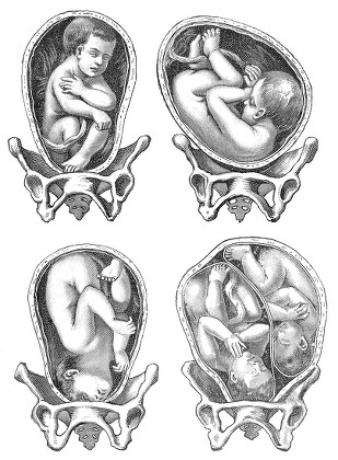 Parturition Various Positions During Childbirth 19th Editorial Stock ...