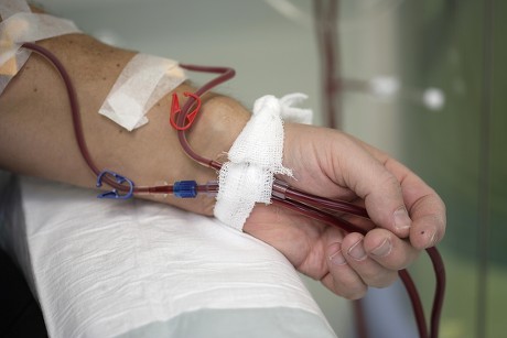 61 Infusion therapy Stock Pictures, Editorial Images and Stock Photos ...