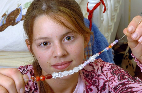 Katharina Esser Aged Three During Treatment Editorial Stock Photo ...