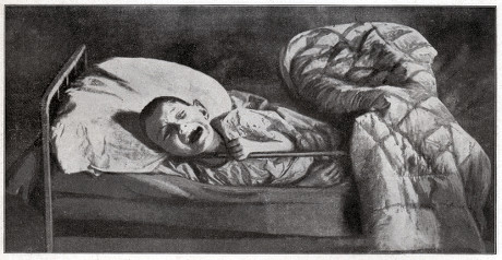 Russian Famine 1921 Child Crying Hospital Editorial Stock Photo - Stock ...