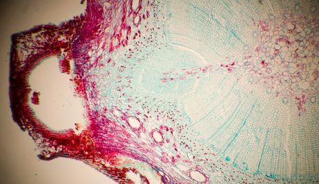 37 Micrographs Stock Pictures, Editorial Images and Stock Photos ...