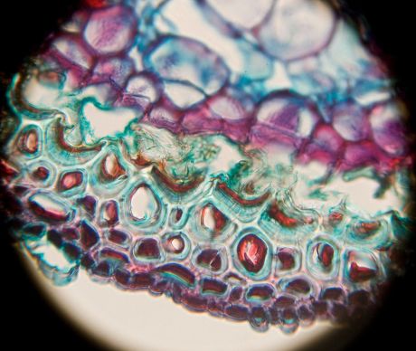 37 Micrographs Stock Pictures, Editorial Images and Stock Photos ...