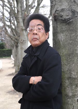 Elephant Man first disease sufferer to receive Face Transplant, Paris ...