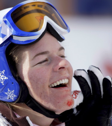 Emily Brydon Canada Fell Scraped Her Editorial Stock Photo - Stock ...