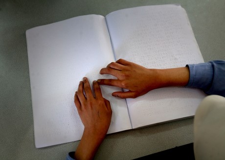 19 Partial blindness Stock Pictures, Editorial Images and Stock Photos ...