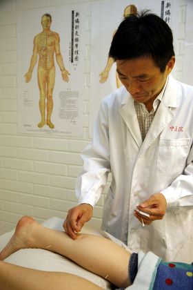 Acupuncture Stock Pictures, Editorial Images and Stock Photos ...