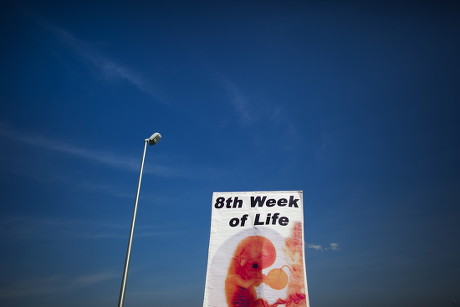 62 Pro life billboards Stock Pictures, Editorial Images and Stock ...