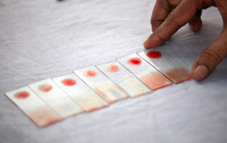 47 Blood test campaign Stock Pictures, Editorial Images and Stock ...