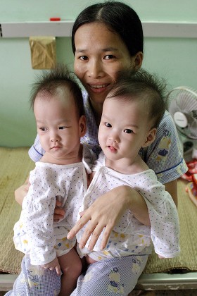 Trinh Thi Binh 30 Holds Her Editorial Stock Photo - Stock Image ...