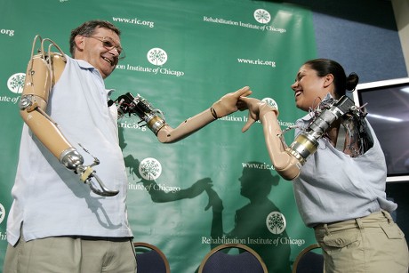 Amputees Claudia Mitchell First Woman Receive Editorial Stock Photo ...