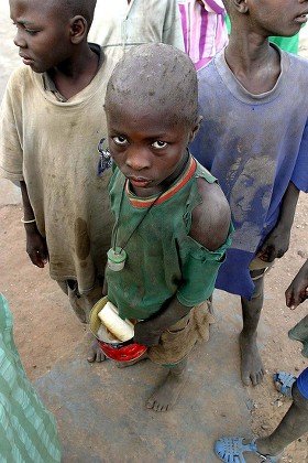 Senegalese Talibe Boy Rests On Street Editorial Stock Photo - Stock ...