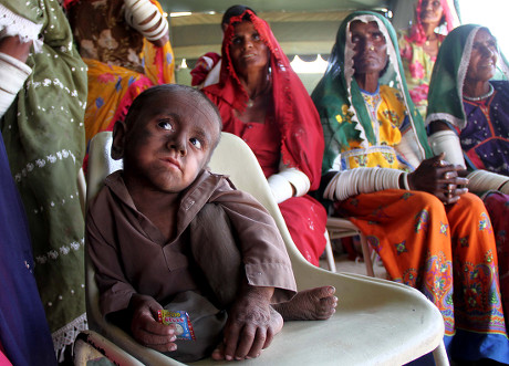 People Affected Famine Wait Get Medical Editorial Stock Photo - Stock ...