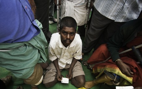 Indian Physically Challenged Boy Receives Artificial Editorial Stock ...