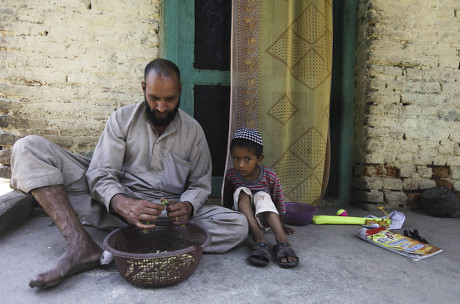 Leper Patient Sits Outside Leprosy Hospital Editorial Stock Photo ...