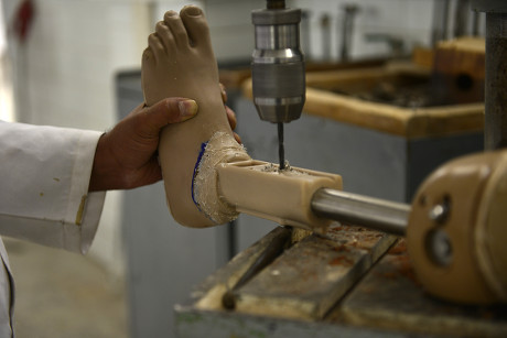 Yemeni Technician Prepares Prosthetic Limbs Before Editorial Stock ...