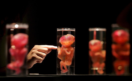 Man Points 14weekold Fetus Exposition Bodies Editorial Stock Photo ...